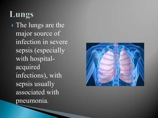 Sepsis powerpoints | PPTX