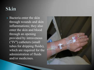 Sepsis powerpoints | PPTX