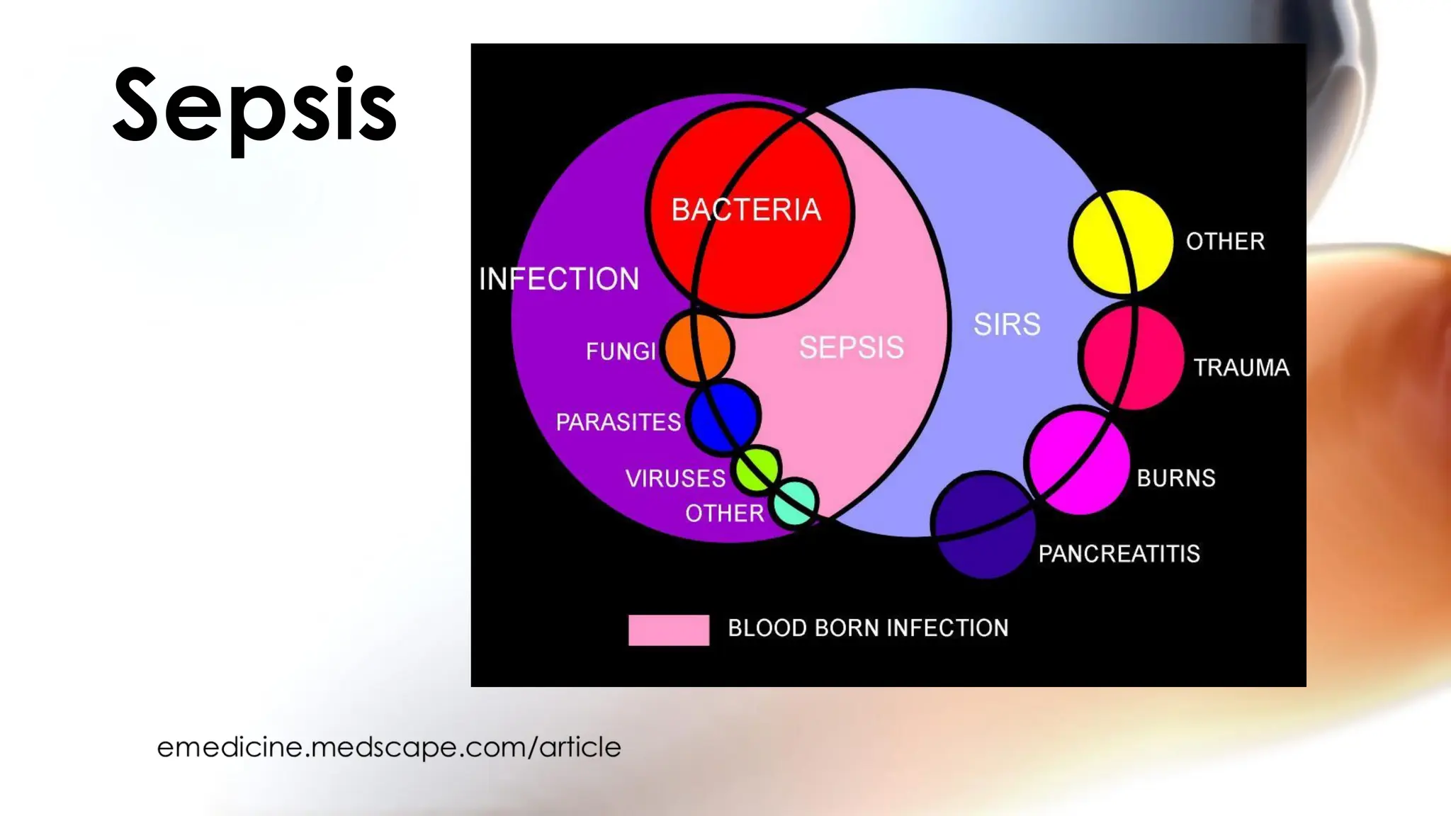 Sepsis Power Point Slides.pdf how to diagnose prevention | PDF