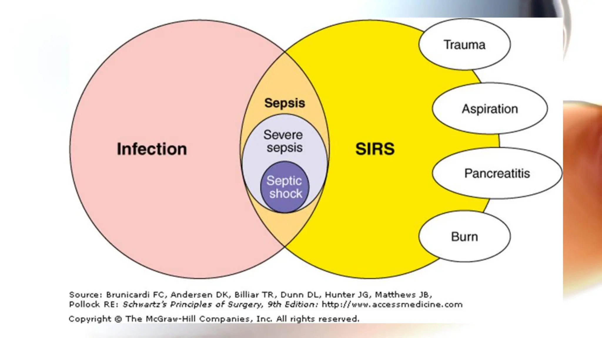 Sepsis Power Point Slides.pdf how to diagnose prevention | PDF