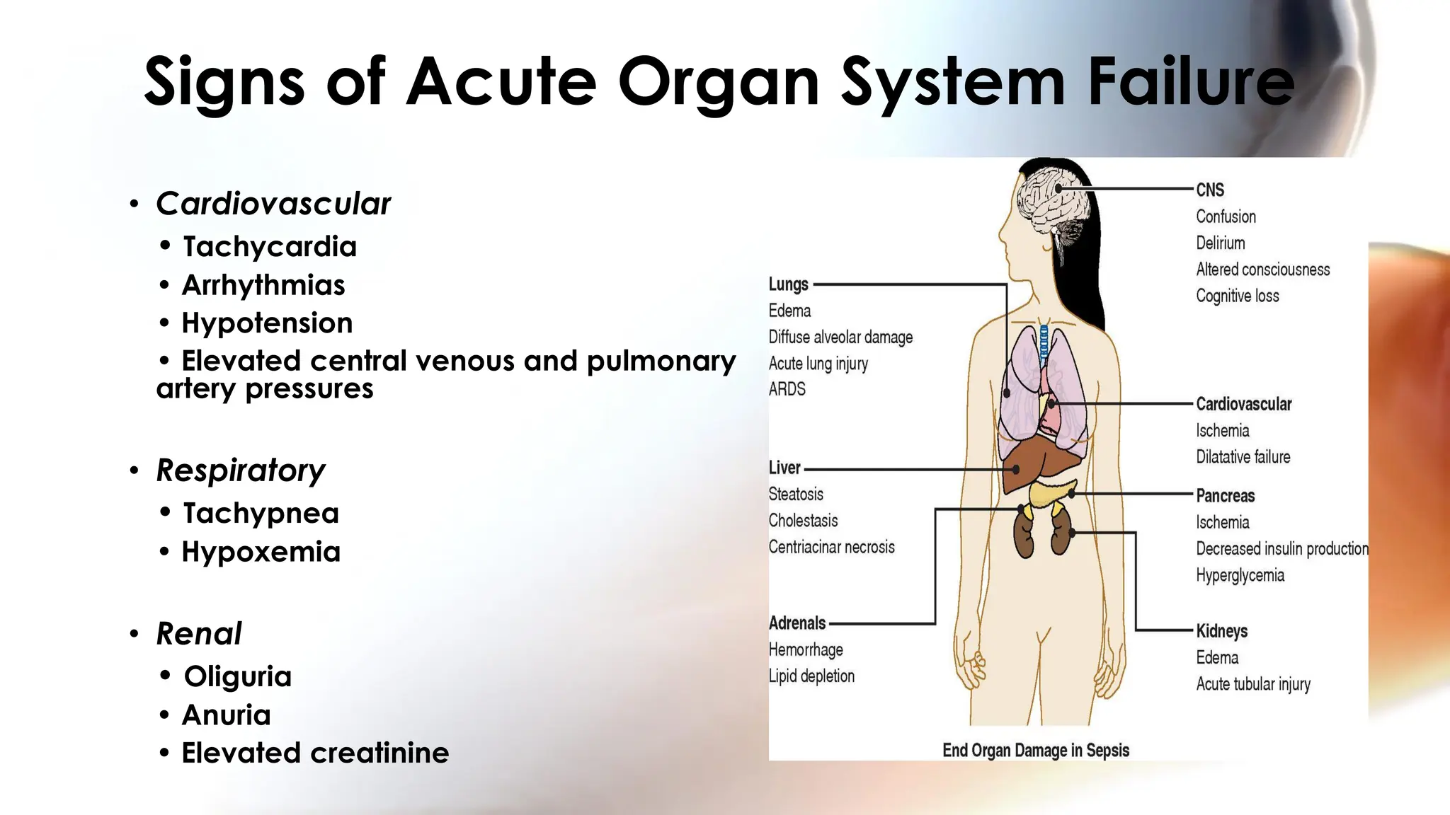 Sepsis Power Point Slides.pdf how to diagnose prevention | PDF