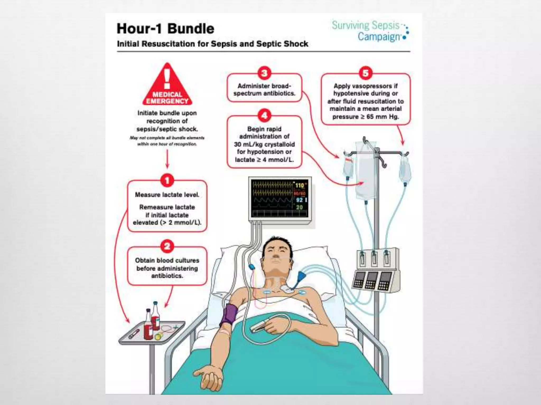 Acute Sepsis - Emergency Management | PPTX