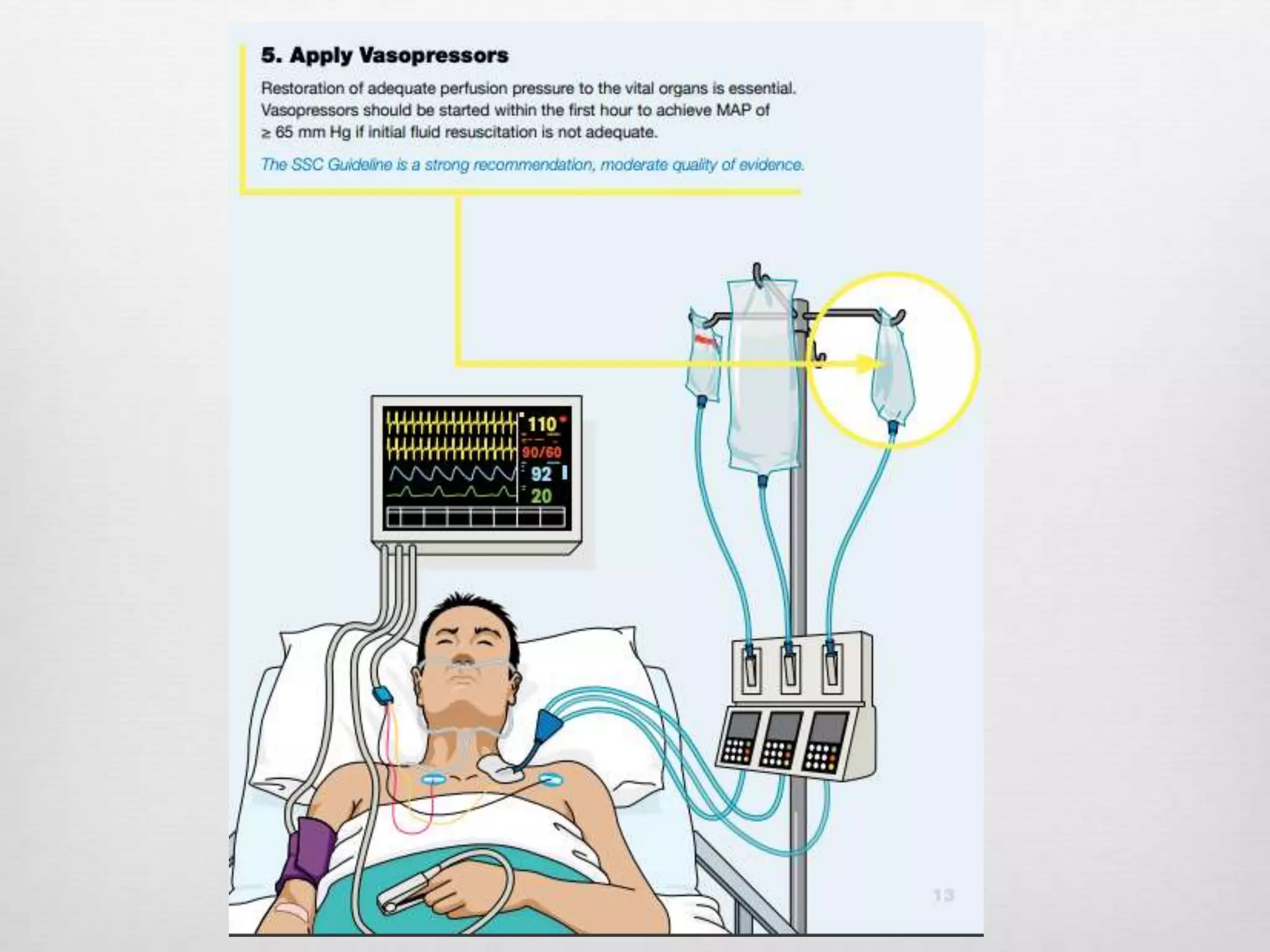 Acute Sepsis - Emergency Management | PPTX