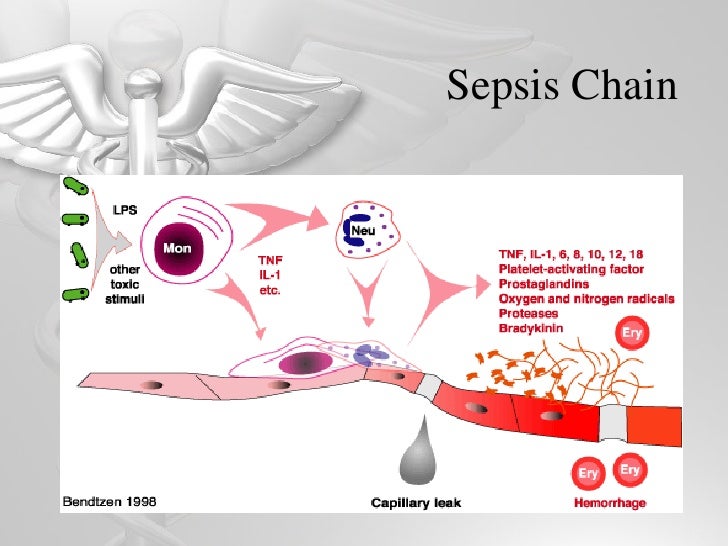 Sepsis project presentation