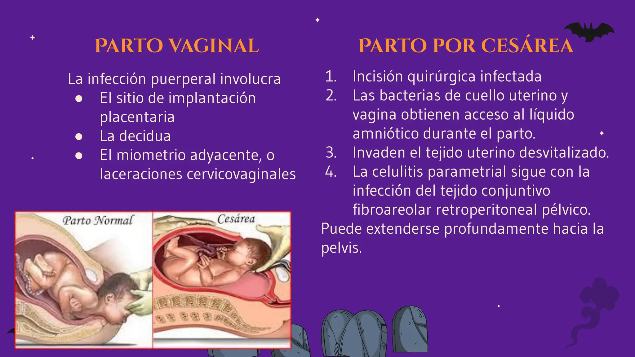Sepsis puerperal y mastitis - maternapdf | PPT