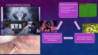 Fisiopatologia de Sepsis y choque séptico | PPTX