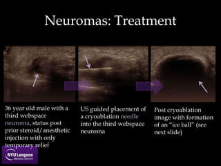 Sept ultrasound case of the month | PPTX