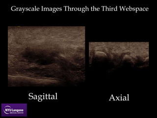 Sept ultrasound case of the month | PPTX