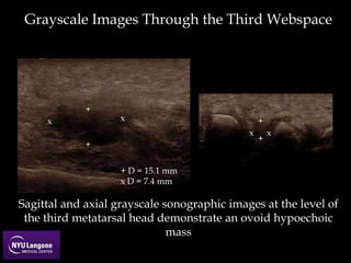 Sept ultrasound case of the month | PPTX