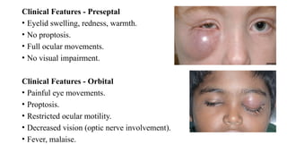 Septal and preseptal orbital cellulitis.pptx