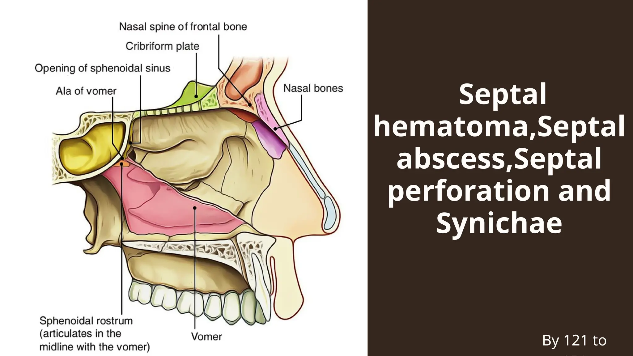 septal hematoma,septal abscess,septal perforation and synichae_20250823 ...