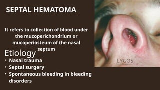 septal hematoma,septal abscess,septal perforation and synichae_20250823 ...