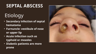septal hematoma,septal abscess,septal perforation and synichae_20250823 ...