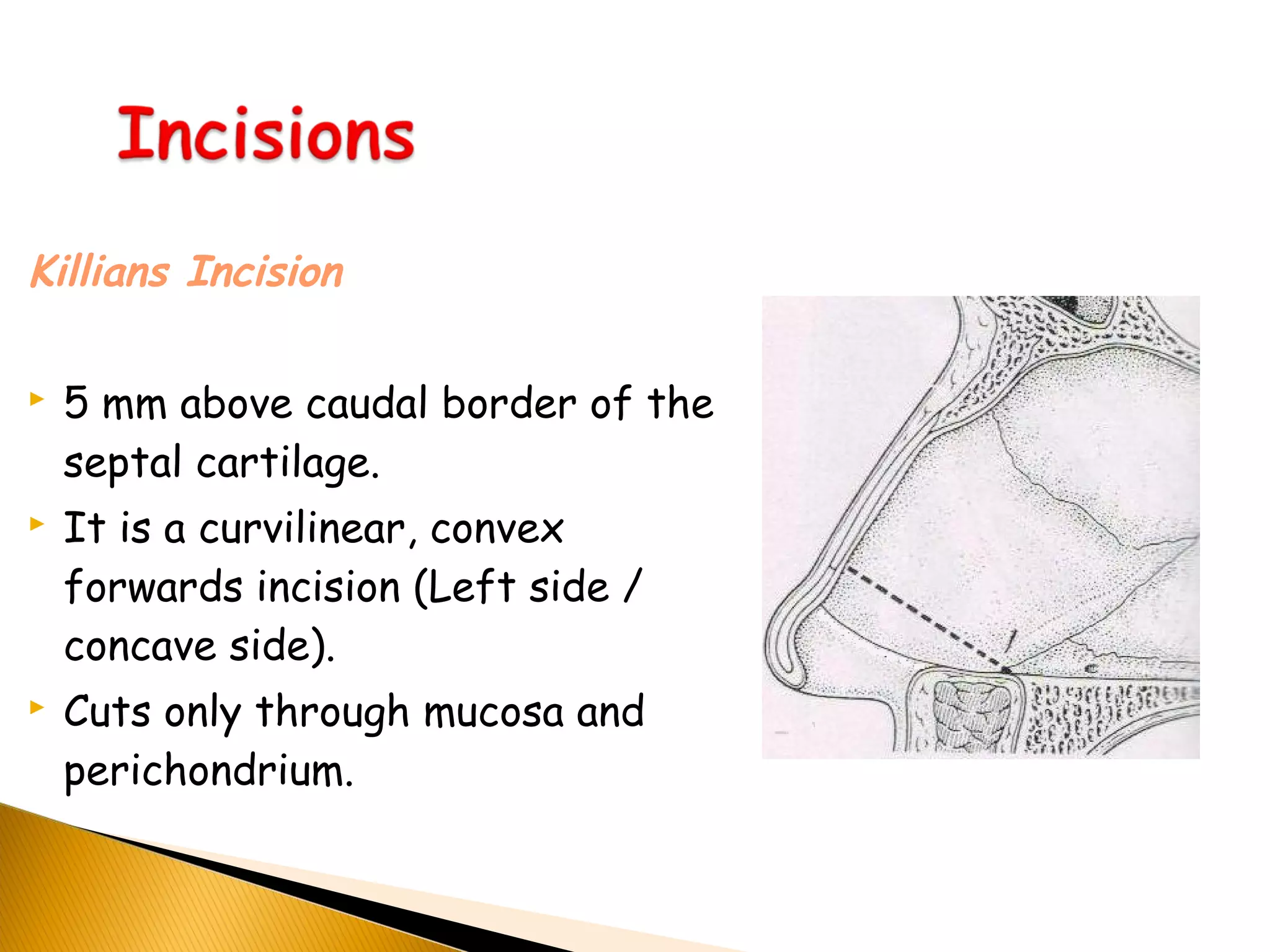 SEPTAL SURGERY & ANTRAL PUNCTURE | PPT