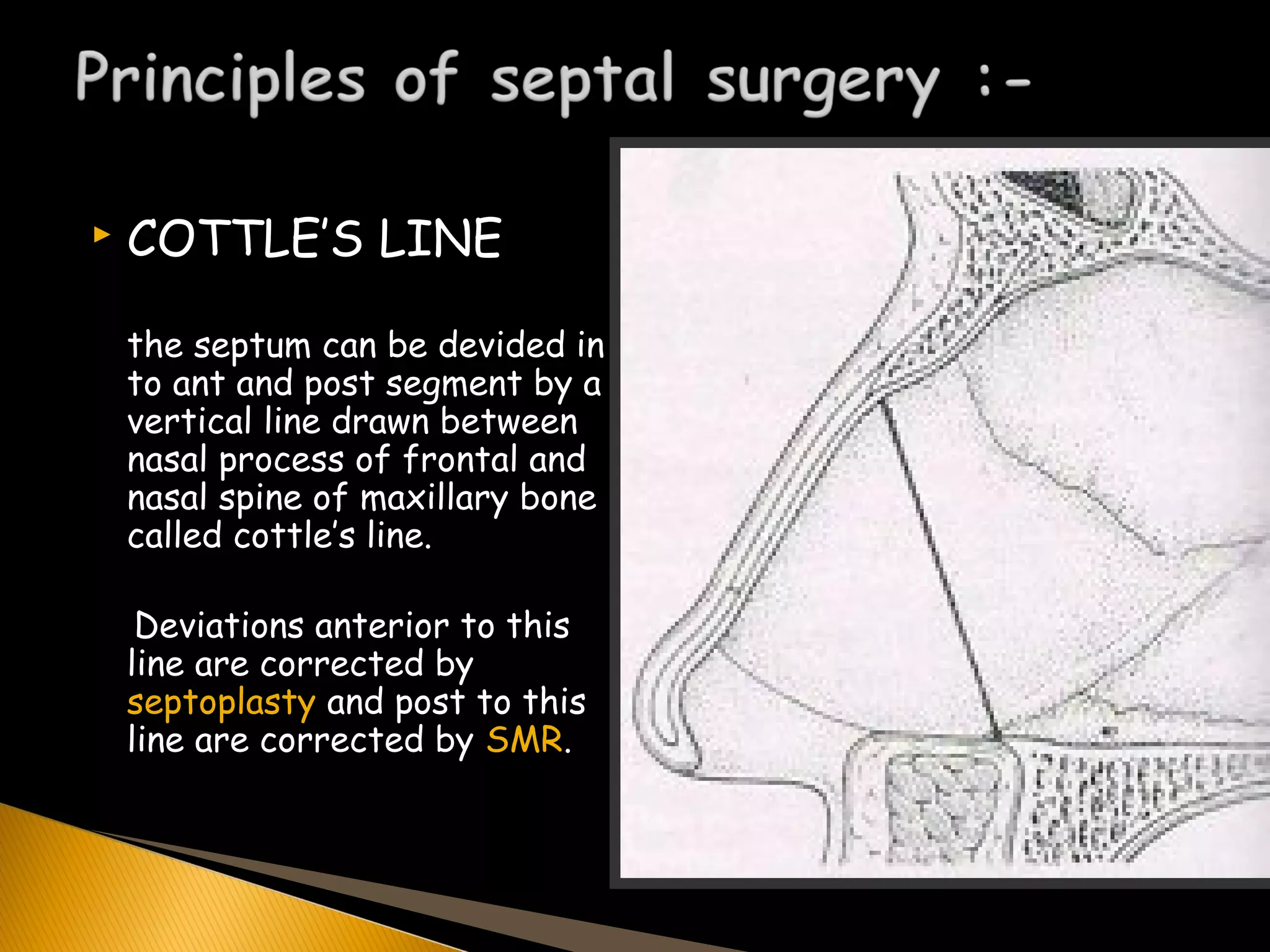 SEPTAL SURGERY & ANTRAL PUNCTURE | PPT