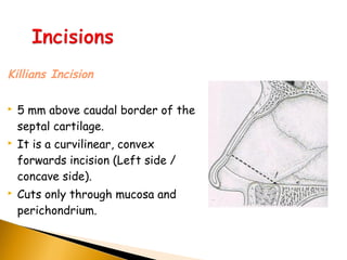 SEPTAL SURGERY & ANTRAL PUNCTURE | PPT