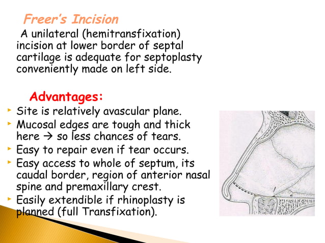 SEPTAL SURGERY & ANTRAL PUNCTURE | PPT | Ear, Nose and Throat ...