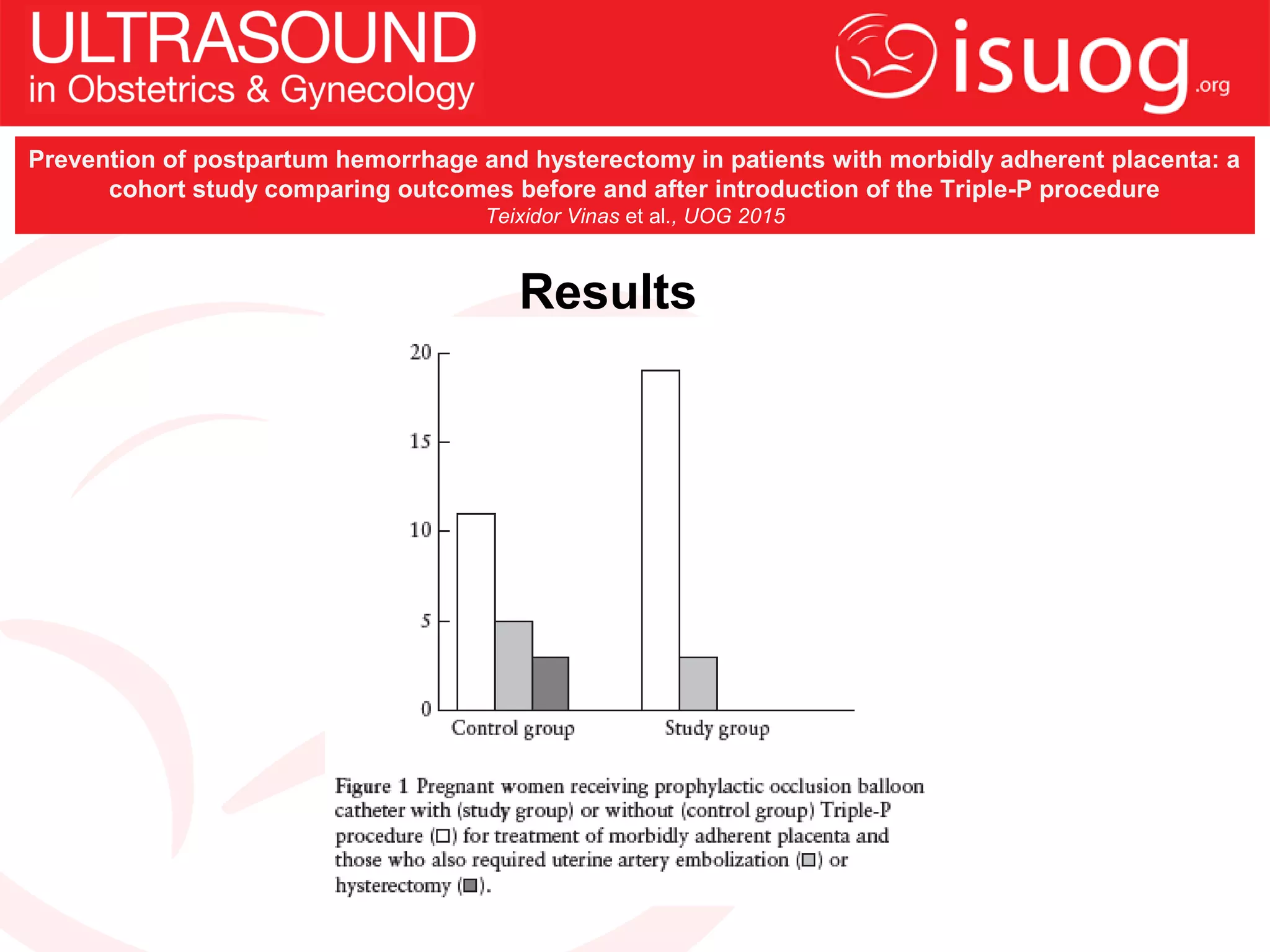 UOG Journal Club: Prevention of postpartum hemorrhage and hysterectomy ...