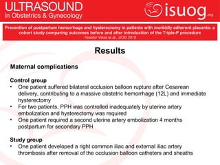 UOG Journal Club: Prevention of postpartum hemorrhage and hysterectomy ...