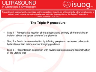 UOG Journal Club: Prevention of postpartum hemorrhage and hysterectomy ...