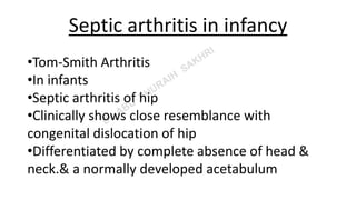 Septic arthritis | PPT