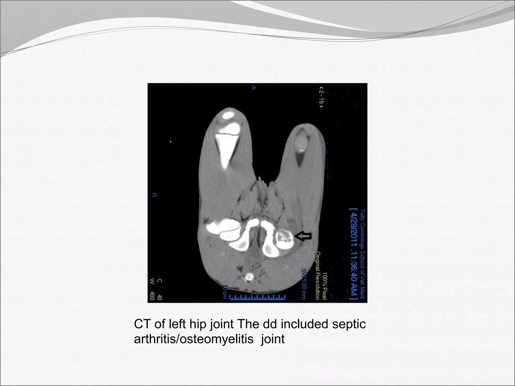 Septic arthritis | PPT