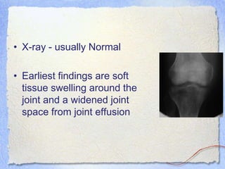 Septic arthritis | PPTX