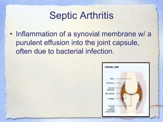 Septic arthritis | PPTX