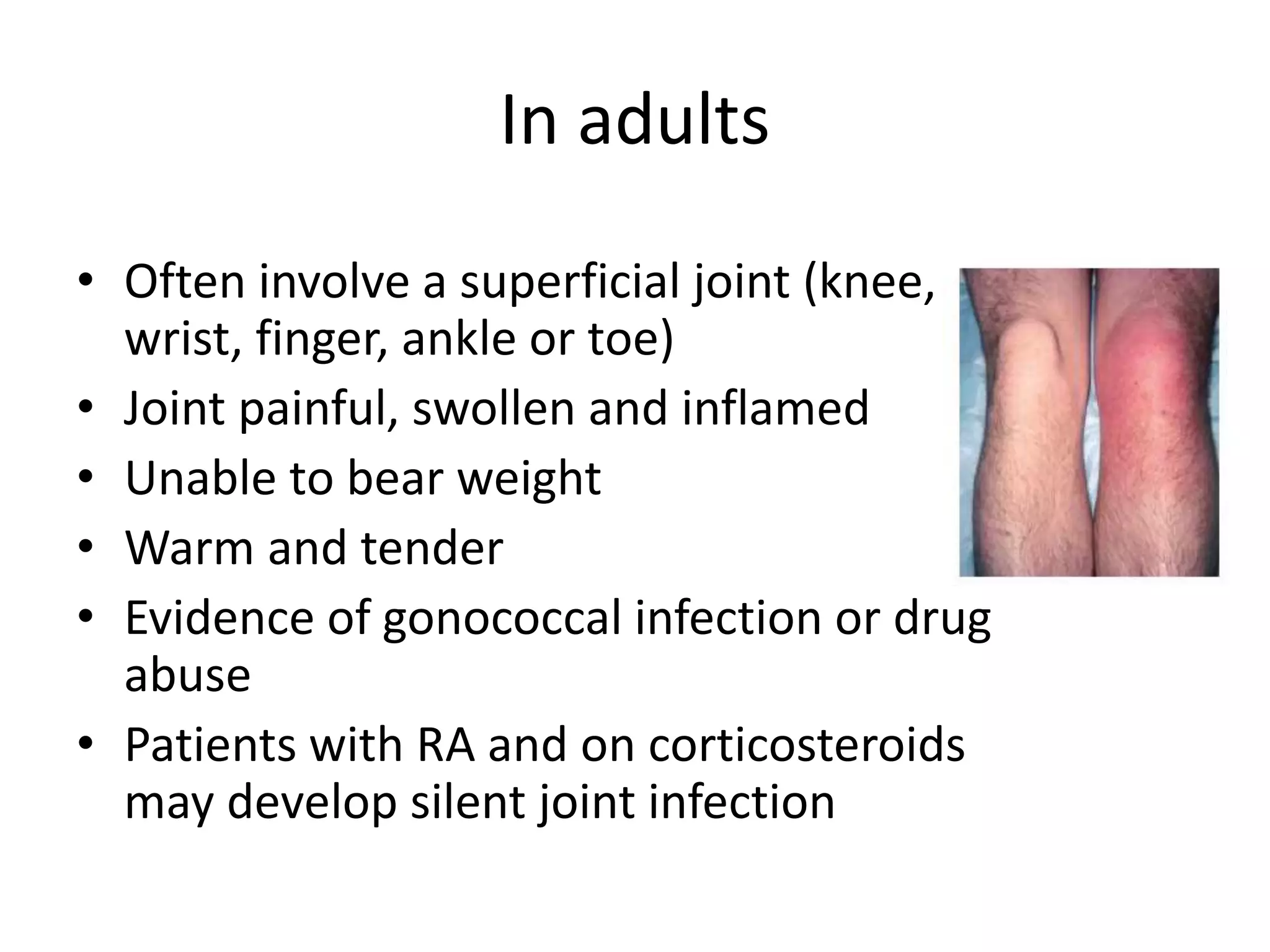 Septic arthritis | PPTX