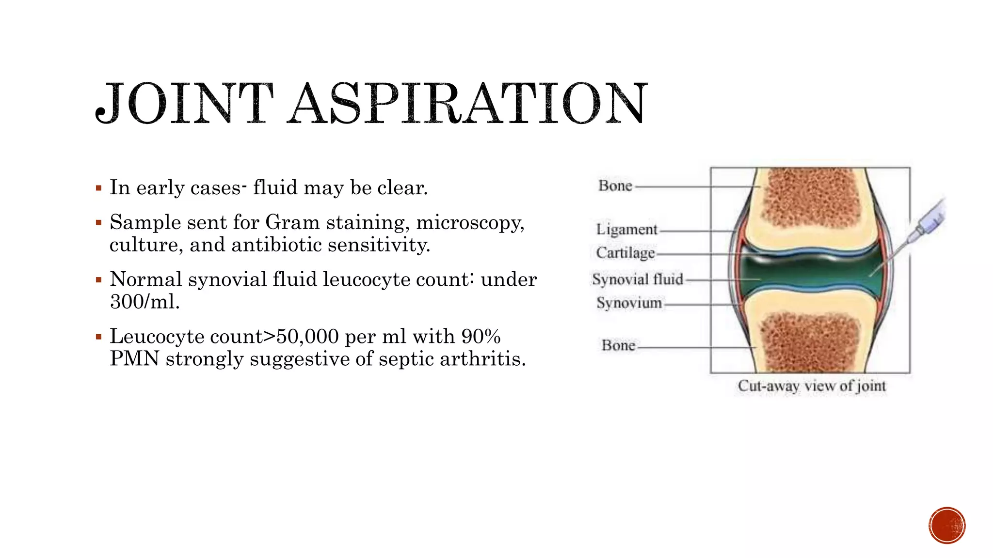 Septic arthritis | PPTX