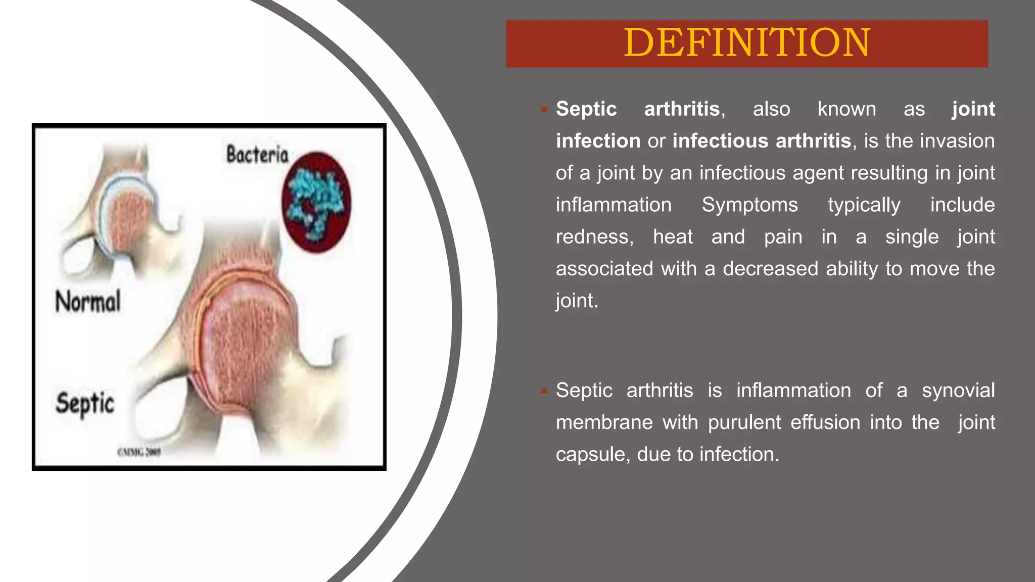 Septic arthritis | PPTX