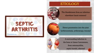Septic arthritis | PPTX