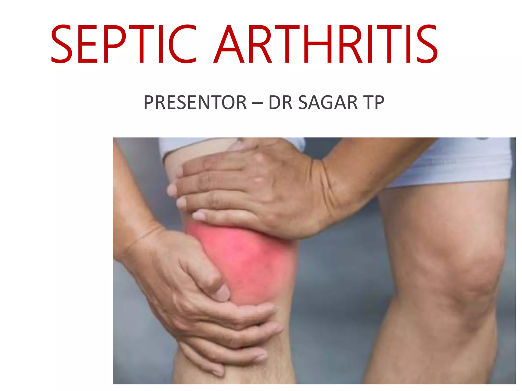 Septic arthritis | PPT