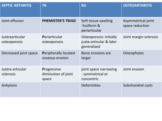 Septic arthritis | PPTX