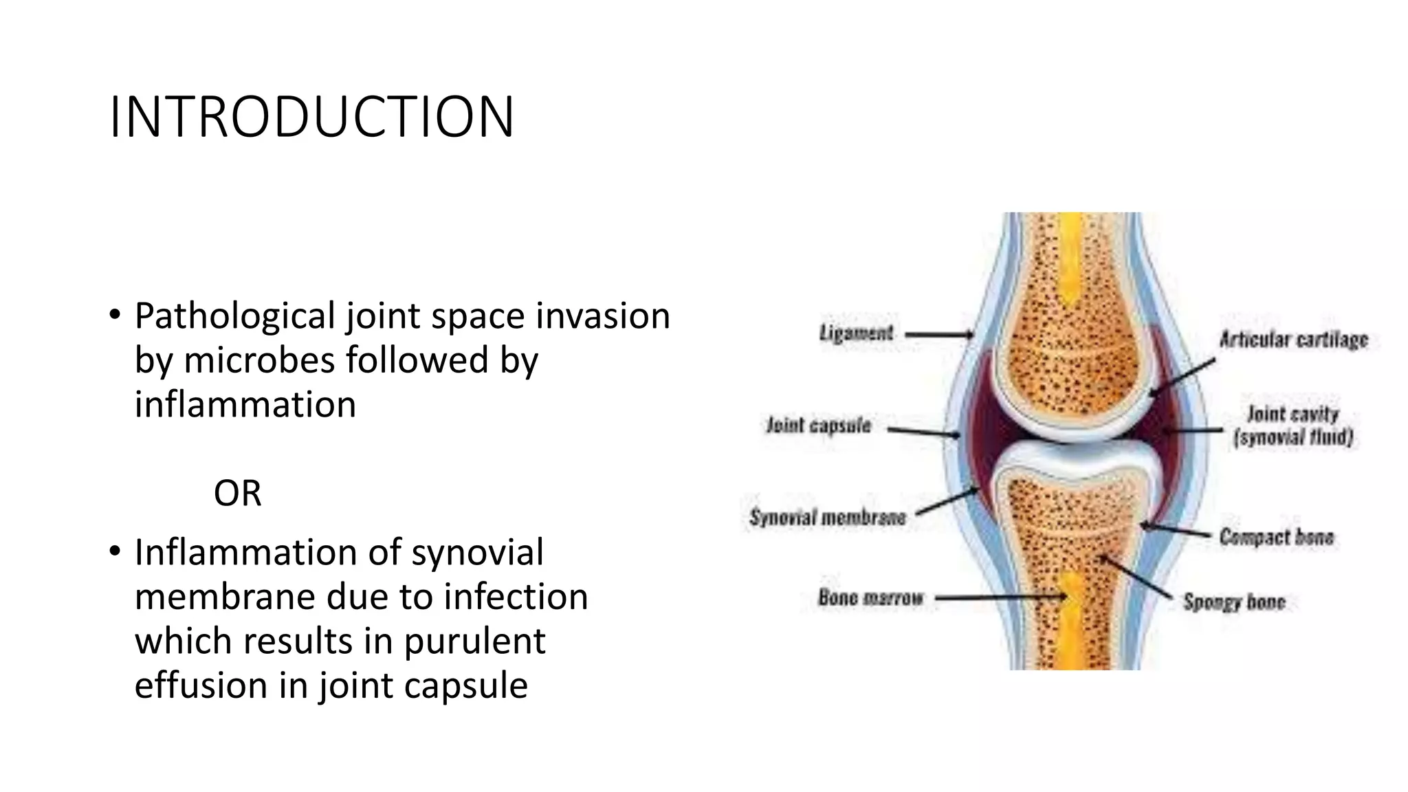 Septic arthritis | PPT