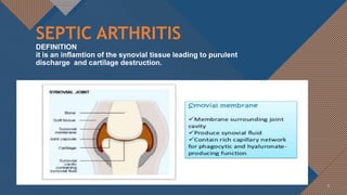 Septic arthritis...5 th stage lecture(dr.farouk) | PPTX
