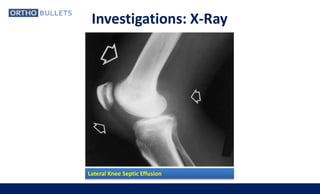 Septic arthritis | PPT