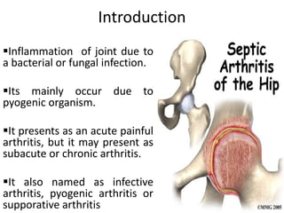 Septic Arthritis | PPTX | Bone and Joint Conditions | Diseases and ...