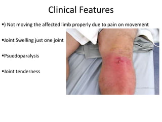 Septic Arthritis | PPTX | Bone and Joint Conditions | Diseases and ...