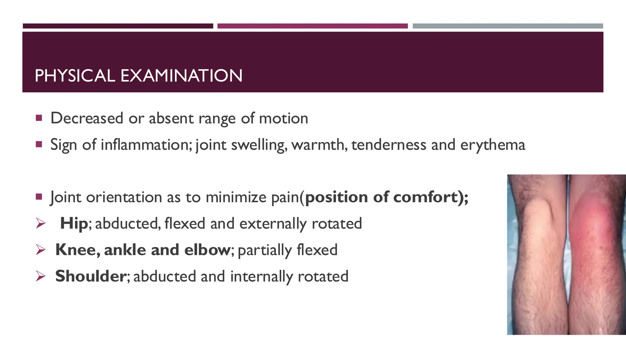 Septic Arthritis| Diagnosis, Management. | PDF