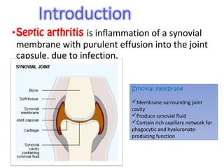 Septic arthritis | PPT