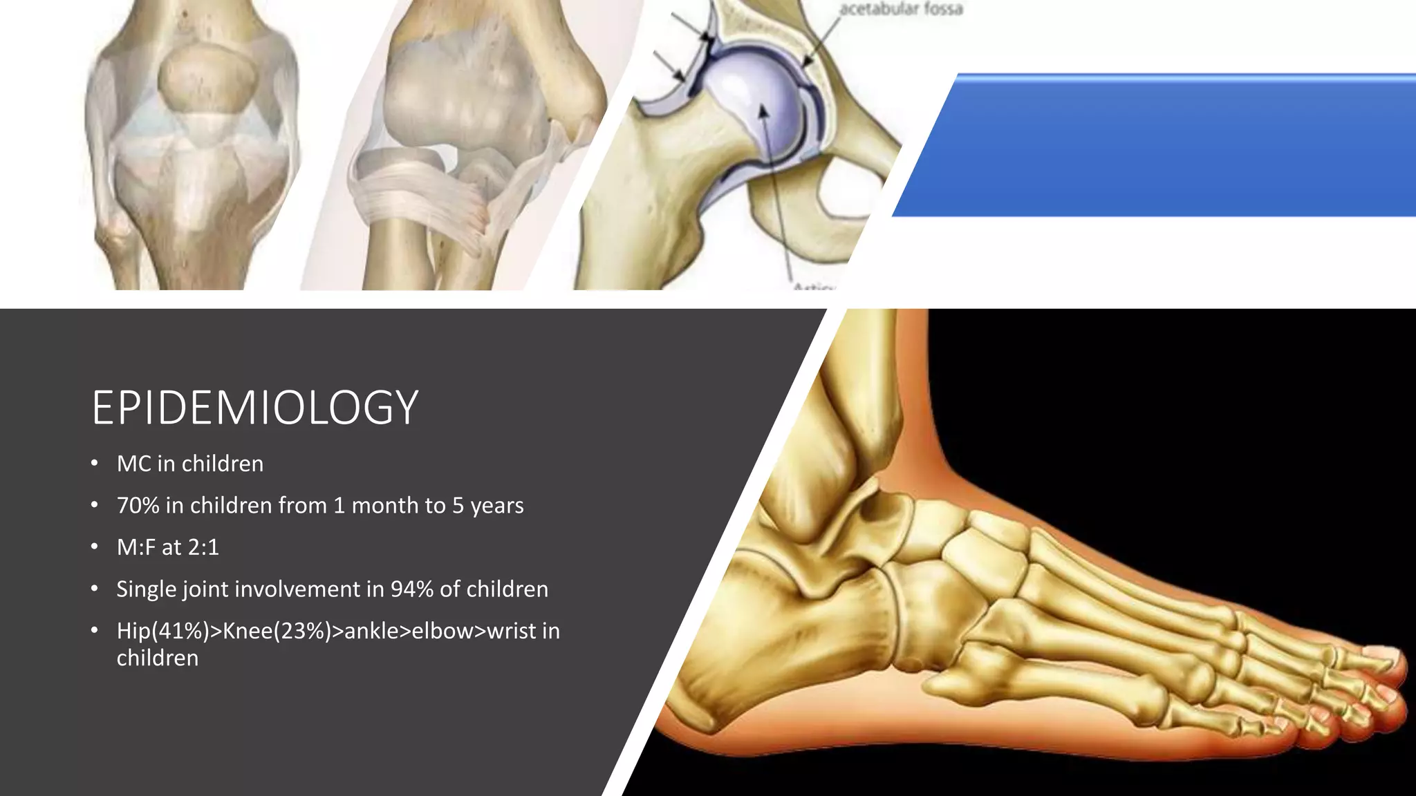 Septic arthritis and sequelae | PPTX