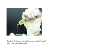 septic arthritis cme .pptx