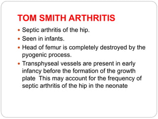 Septic arthritis in children | PPTX