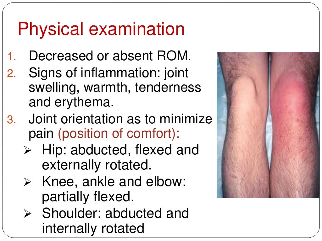 Septic arthritis in children