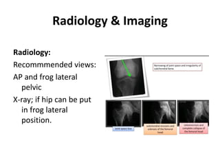 Septic Arthritis of hip in children.pptx