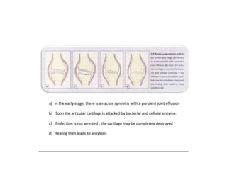 Septic Arthritis of hip in children.pptx