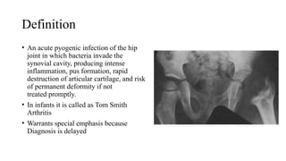 Septic arthritis of hip in infancy.pptxt | PPTX