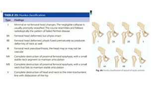 Septic arthritis of hip in infancy.pptxt | PPTX