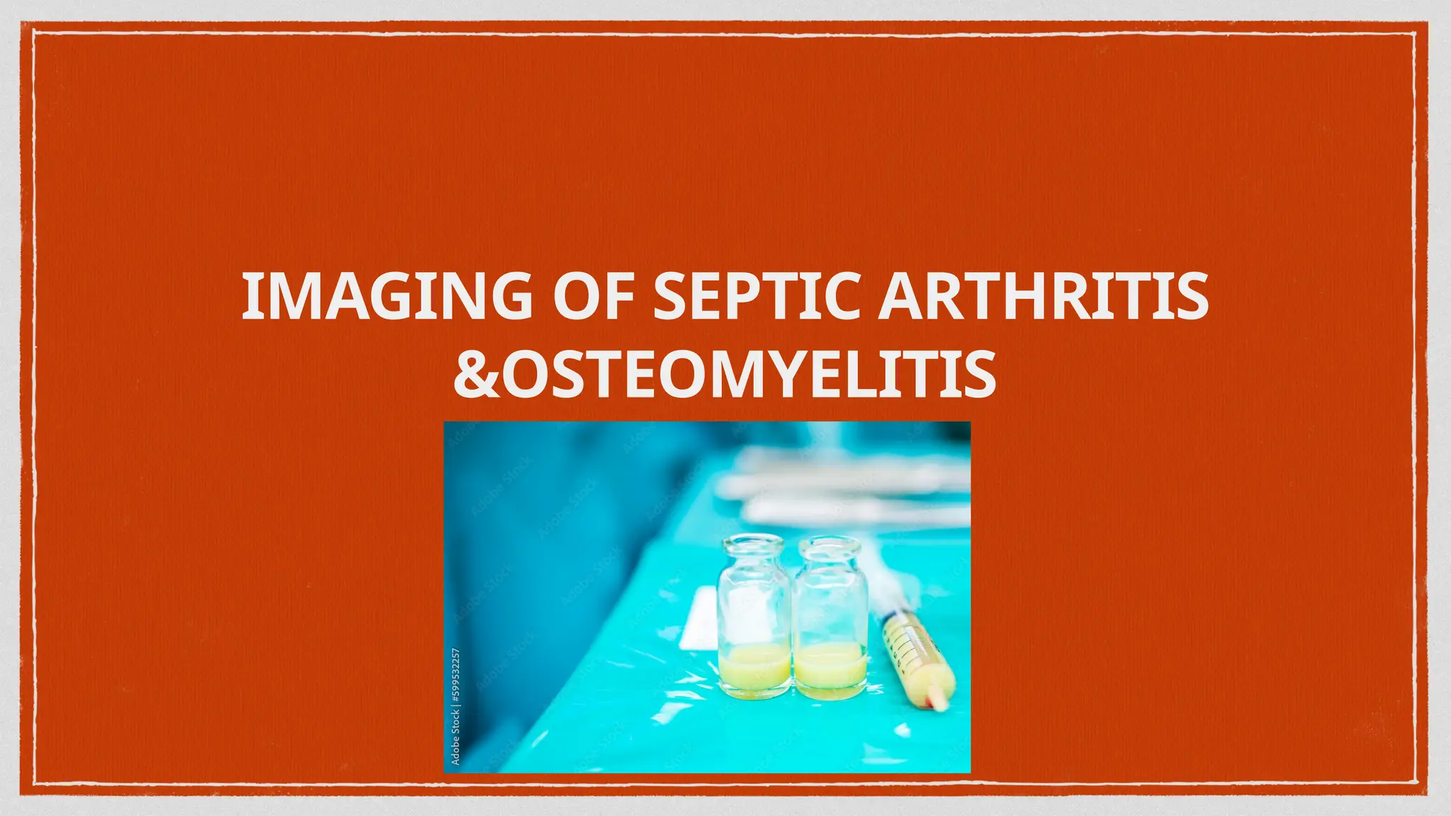SEPTIC ARTHRITIS & OSTEOMYELITIS IMAGINGIS.pptx